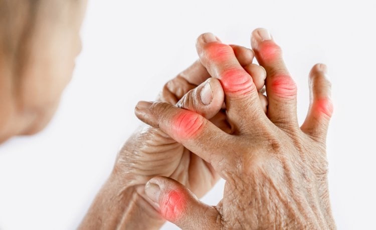 Heferol® 350 mg tvrde kapsule- upute i komentari | Kreni zdravo!