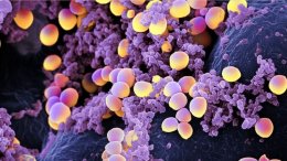 Stafilokok – simptomi infekcije i liječenje | Kreni zdravo!