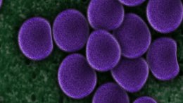 Stafilokok – simptomi infekcije i liječenje | Kreni zdravo!