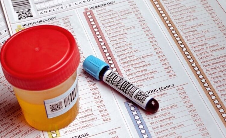 Torecan čepići (6,5mg) – Uputa o lijeku | Kreni zdravo!