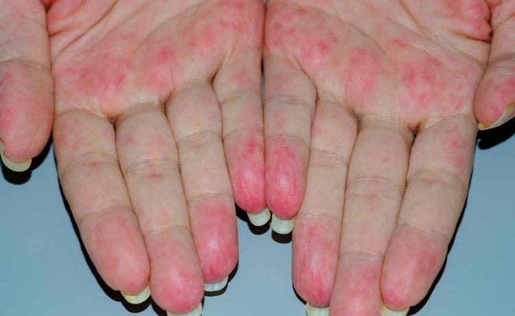 Helex tablete (alprazolam) | Kreni zdravo!