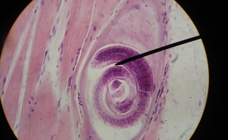 Ciprofloksacin (250/500/750mg) – Uputa o lijeku | Kreni zdravo!