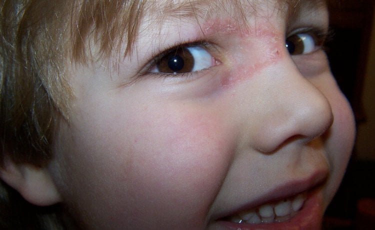 Visine kapi za oko (0,5ml) – Uputa o lijeku | Kreni zdravo!