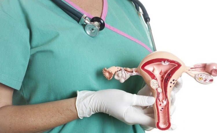 Sindrom policističnih jajnika (PCOS) – uzroci i liječenje | Kreni zdravo!