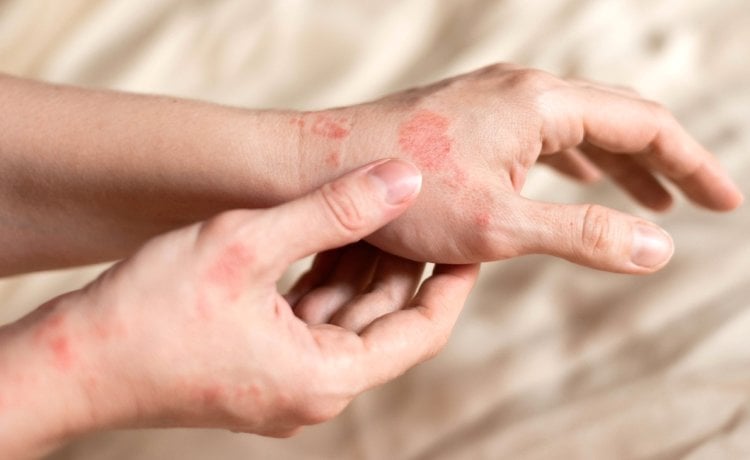 Visine kapi za oko (0,5ml) – Uputa o lijeku | Kreni zdravo!