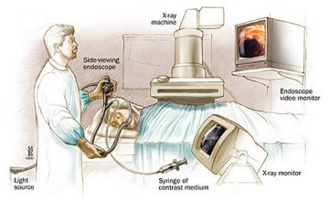 ERCP – što je, kada se izvodi, kako izgleda, cijena | Kreni zdravo!