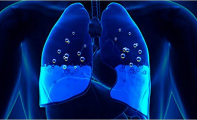 Edem – uzroci, simptomi i liječenje | Kreni zdravo!