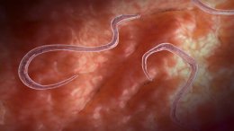 Antiparazitni program – čišćenje od parazita kod ljudi