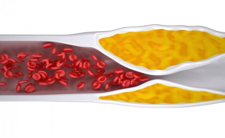Rosix tablete (5/10/20/40 mg) – Uputa o lijeku | Kreni zdravo!