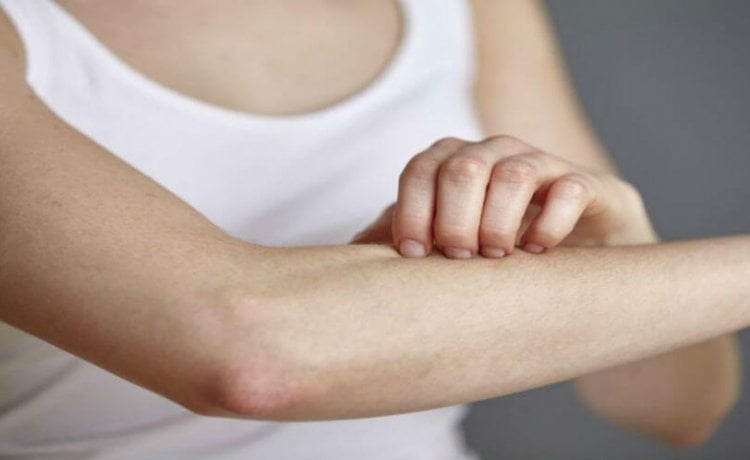 Xyzal tablete (5 mg) – Uputa o lijeku | Kreni zdravo!