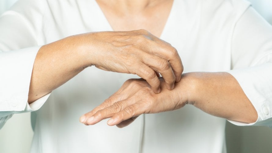 Ispucale ruke do krvi | Kreni zdravo!