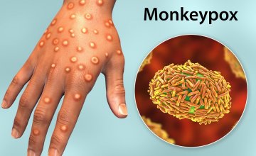 GEOKORTON® mast 20 g- uputstva | Kreni zdravo!