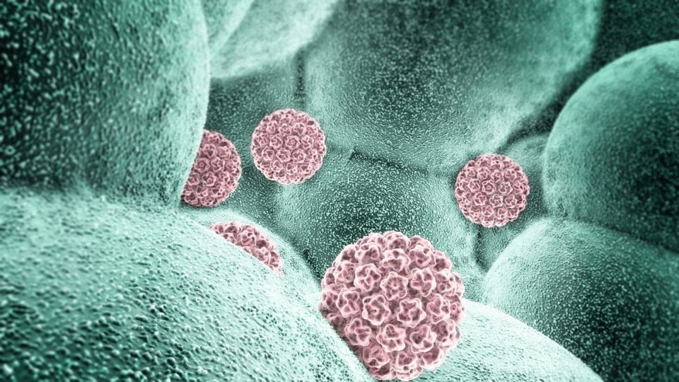 Visokorizični HPV: Liječnik otkriva koliko je opasan