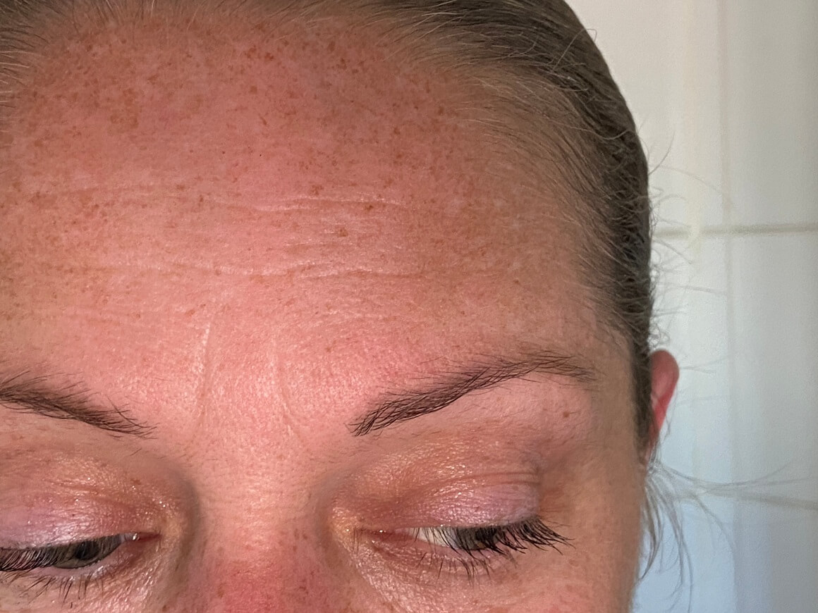 Bolesti nadbubrežnih žlijezda: 10 poremećaja i simptomi