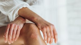 Najčešće kožne bolesti: Simptomi i uzroci